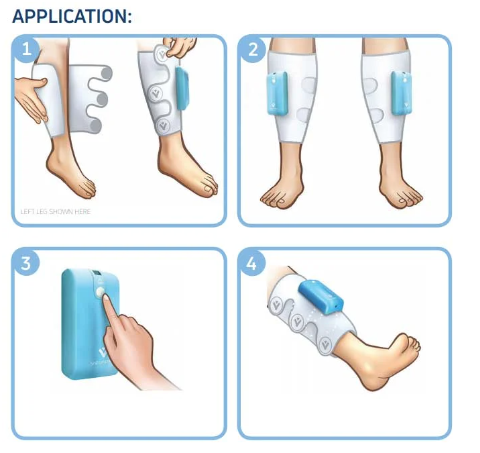 Pisces Healthcare Solutions. VenaPro DVT Leg Compression Device